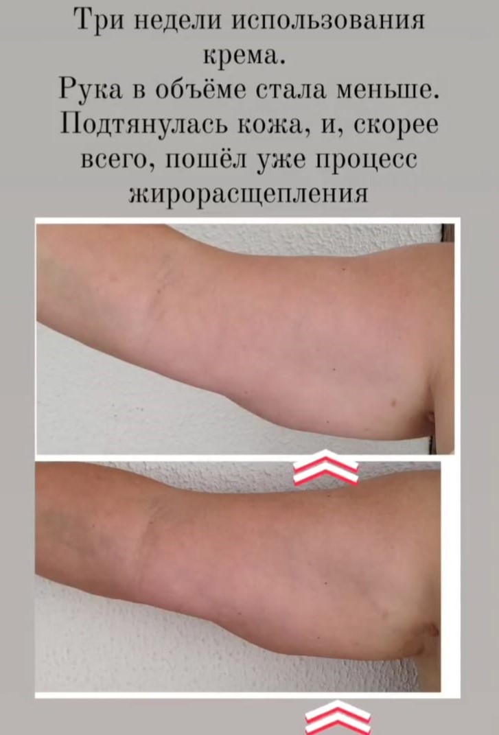 Лимфодренажный лосьон для тела